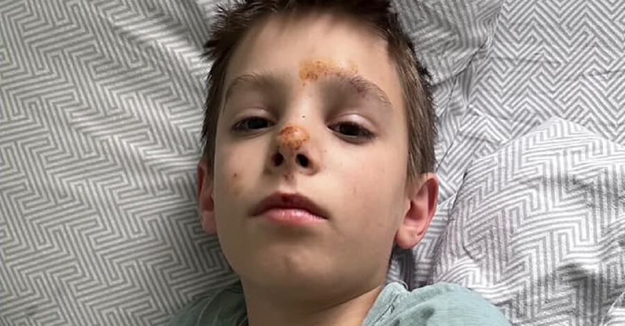 У Василькові дитину зіштовхнули з парапету біля школи - Новини на KP.UA